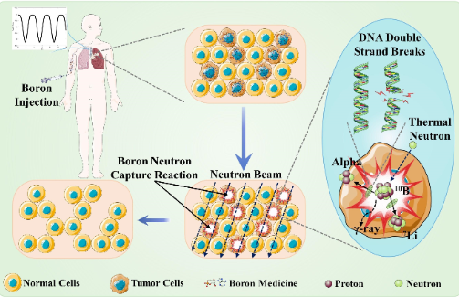 boron radiotherapy